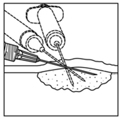 Product Images Imlygic Photos - Packaging, Labels & Appearance