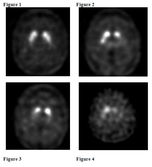 Product Images Datscan Photos - Packaging, Labels & Appearance